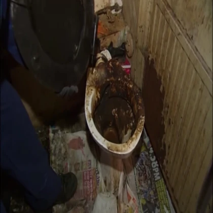 Diarrhea