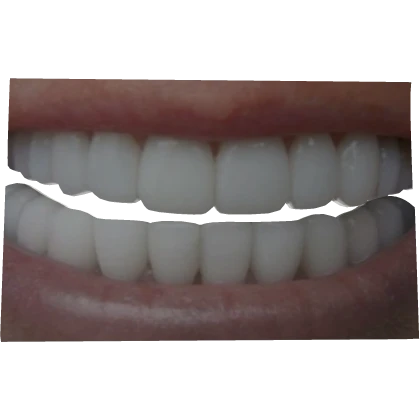 teeth | Roblox Item - Rolimon's