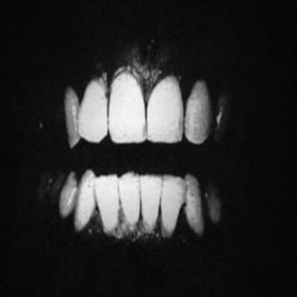 Analog horror teeth