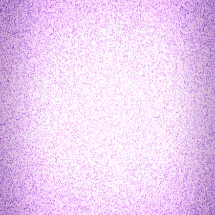 Pink TV Static