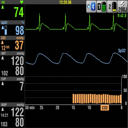 Lifepak 15 Screen