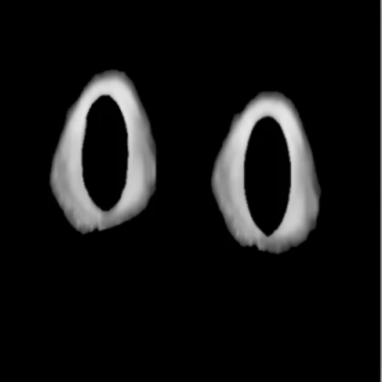 Alternate Eyes 2 [Mandela catalogue]